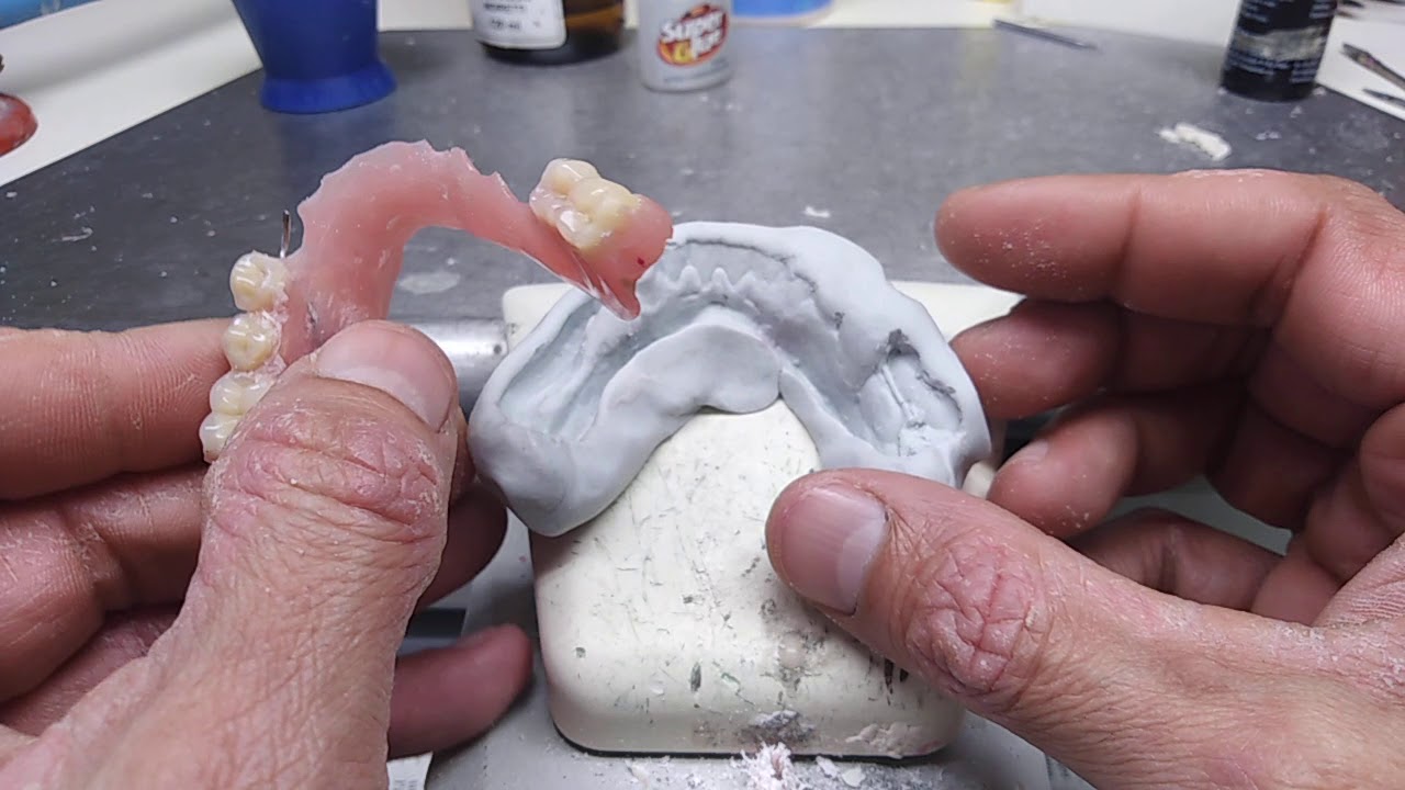 Riparazione protesi mobile. 6 Dental Formula project - YouTube