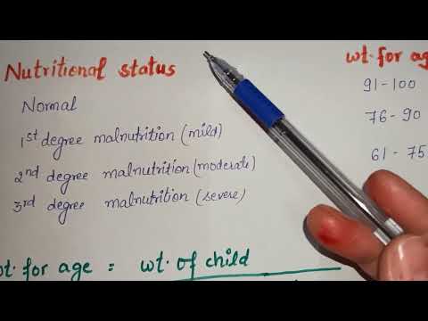 Assessment of Nutritional Status according to Gomez classification #gomez #nutritionalstatus