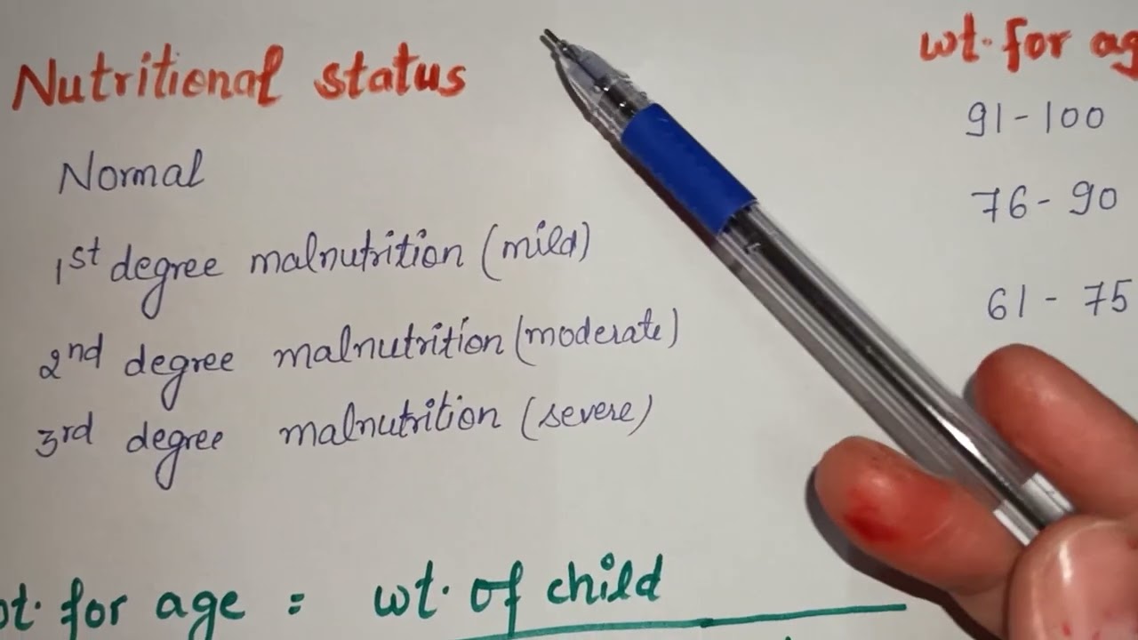 Assessment of Nutritional Status according to Gomez classification # ...