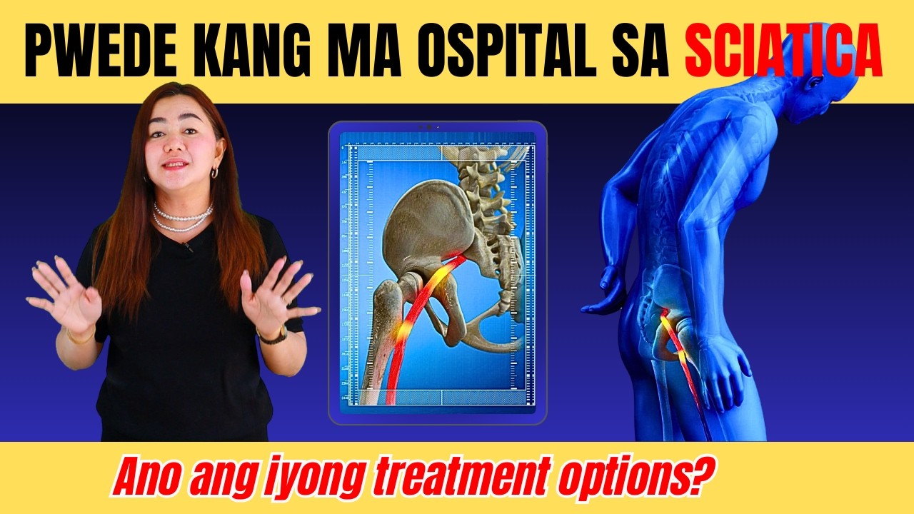 GAANO Ba Ka DELIKADO Ang SCIATICA? Kailan ito maituturing na isang ...