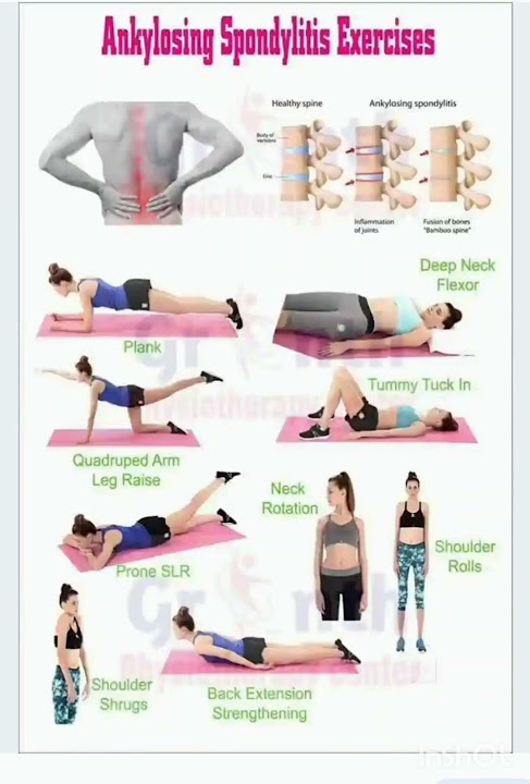Ankylosing spondylitis exercises - YouTube