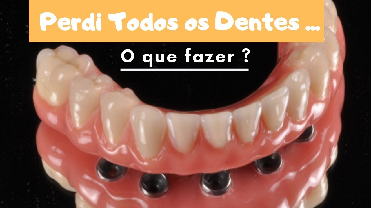 Perdi todos os Dentes, e Agora? - YouTube