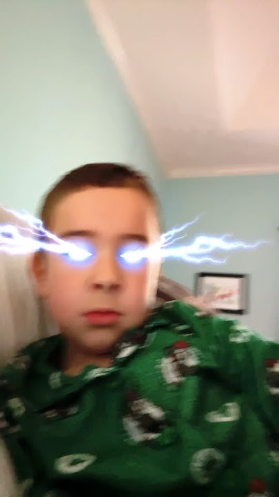 I got struck by lightning - YouTube