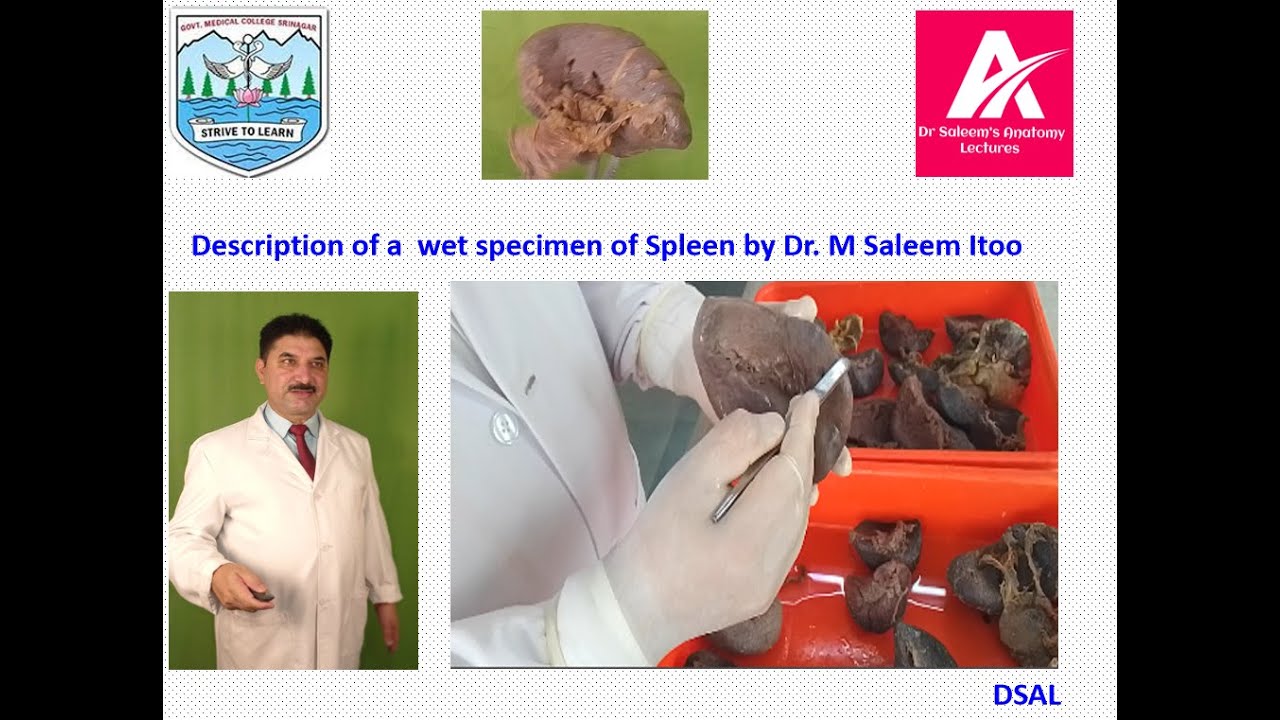 Wet Specimens of Spleen for Practical Examination by Prof (Dr ...