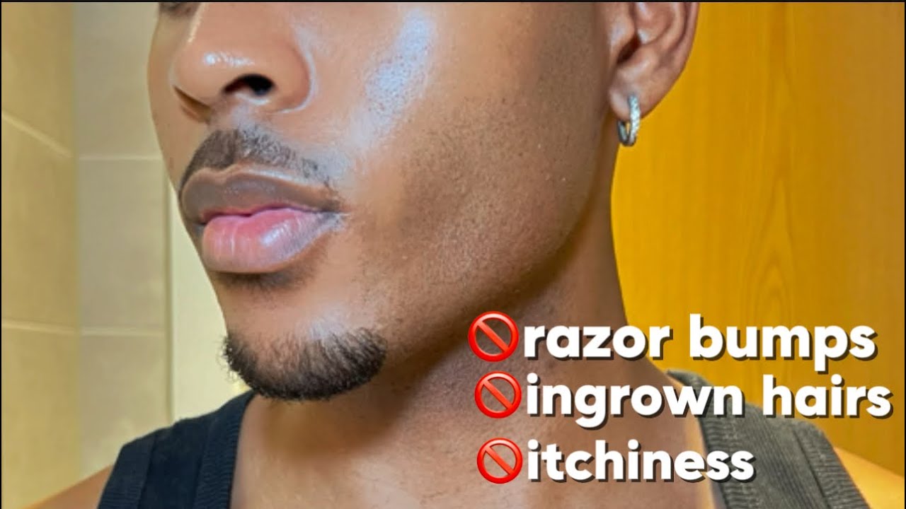 How to get rid of razor bumps & ingrown hairs (Tutorial) - YouTube