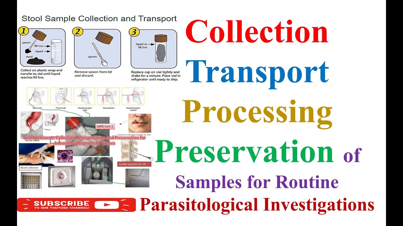 Collection, Transport, Processing & Preservation of Sample for Routine ...