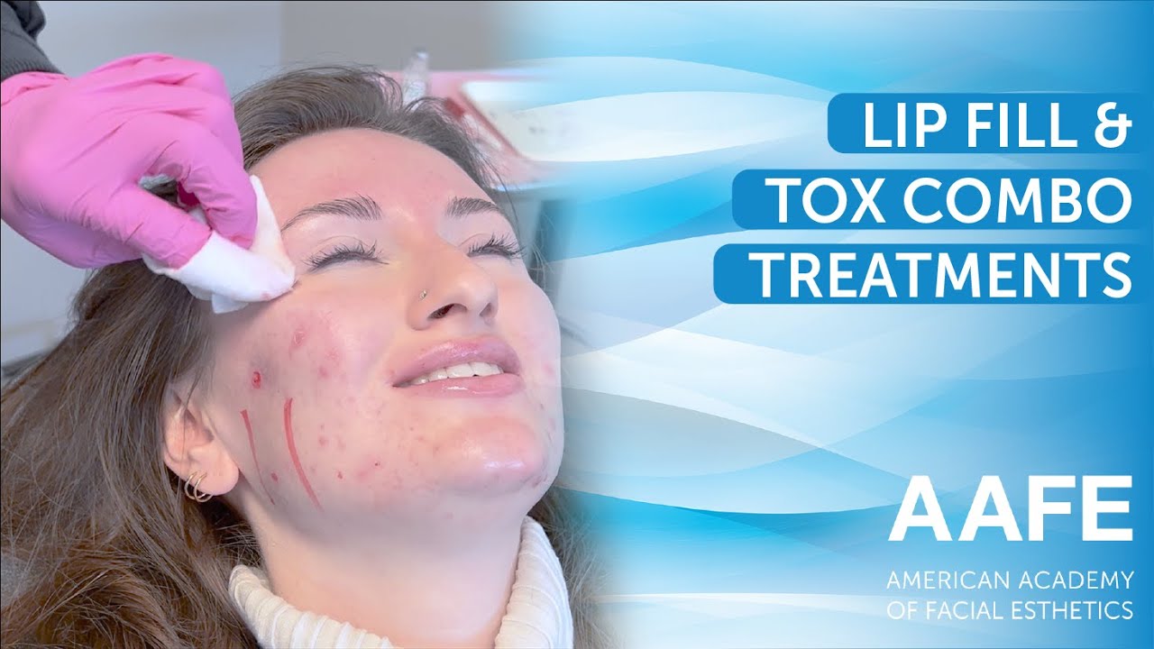 Lip Fill & Tox Combo Treatments - YouTube