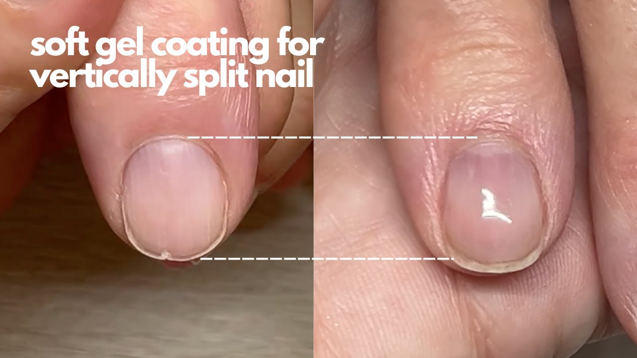 Can you repair a vertically splitting nail with gel? - YouTube