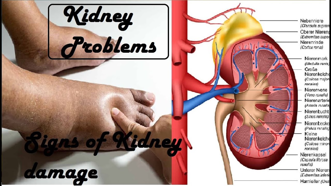 Kidney Problems, How Kidney damage: Homeostasis, Biology, Book 2, Pre ...