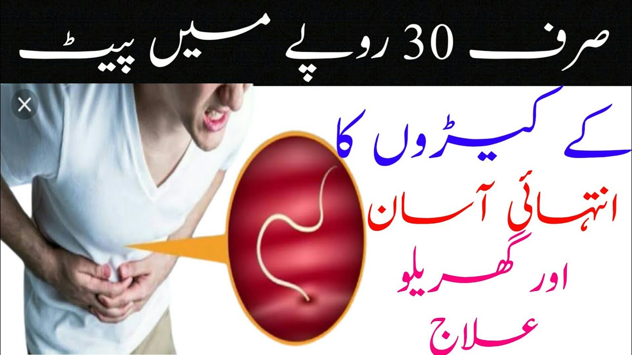 Pait Ke Keede Ka Ilaj Pait K Keeray Ka In Urdu Pait K Keeray Kaise pait-ke-keede-ka-ilaj-pait-k-keeray-ka-in-urdu-pait-k-keeray-kaise