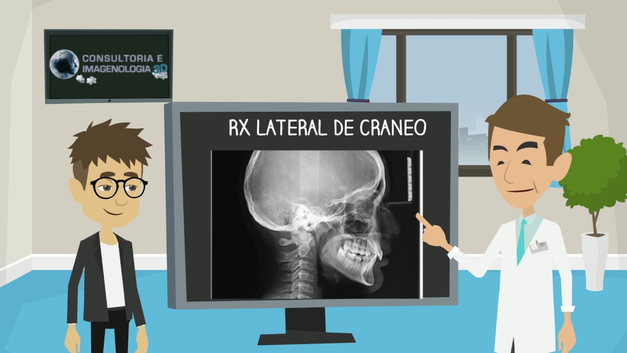 Anatomía De La Radiografía Lateral Del Cráneo AP Lateral De Craneo