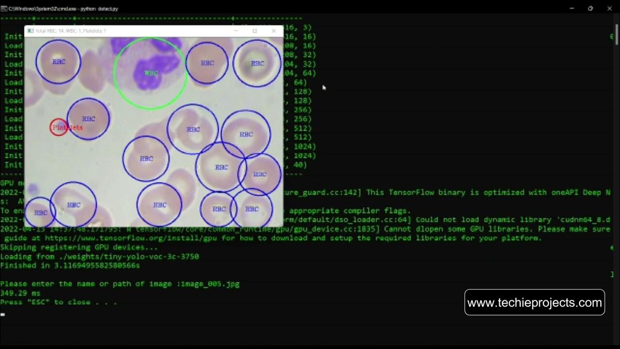 Blood Cell Counting using Image Processing | Python Projects for Resume - YouTube