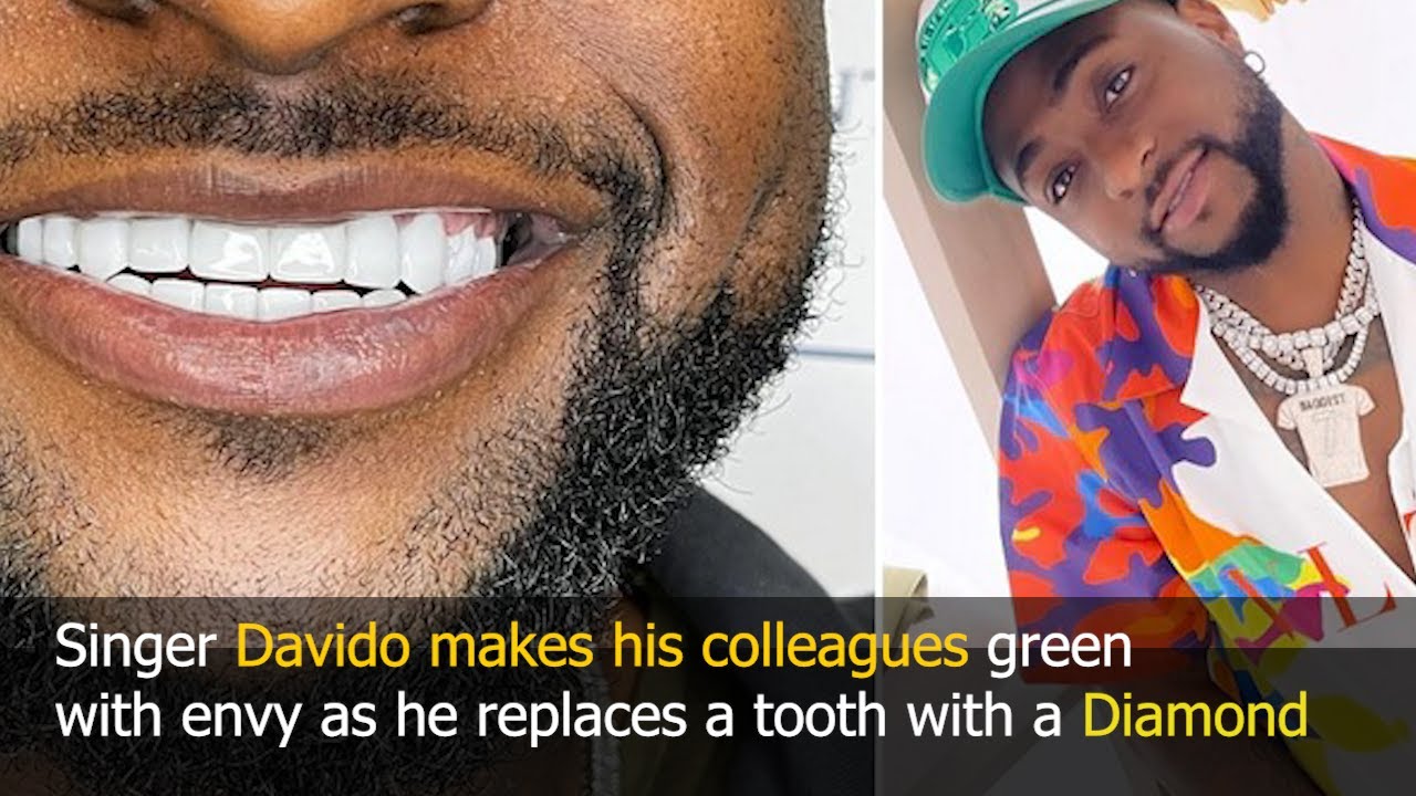 Davido Gets Diamond-Encrusted Tooth, Wizkid Envied - YouTube