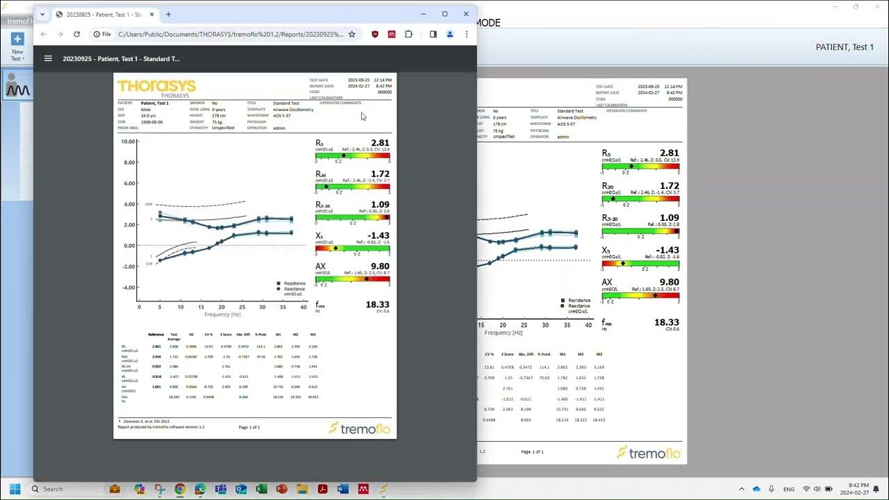Thorasys How To: Data Review - YouTube