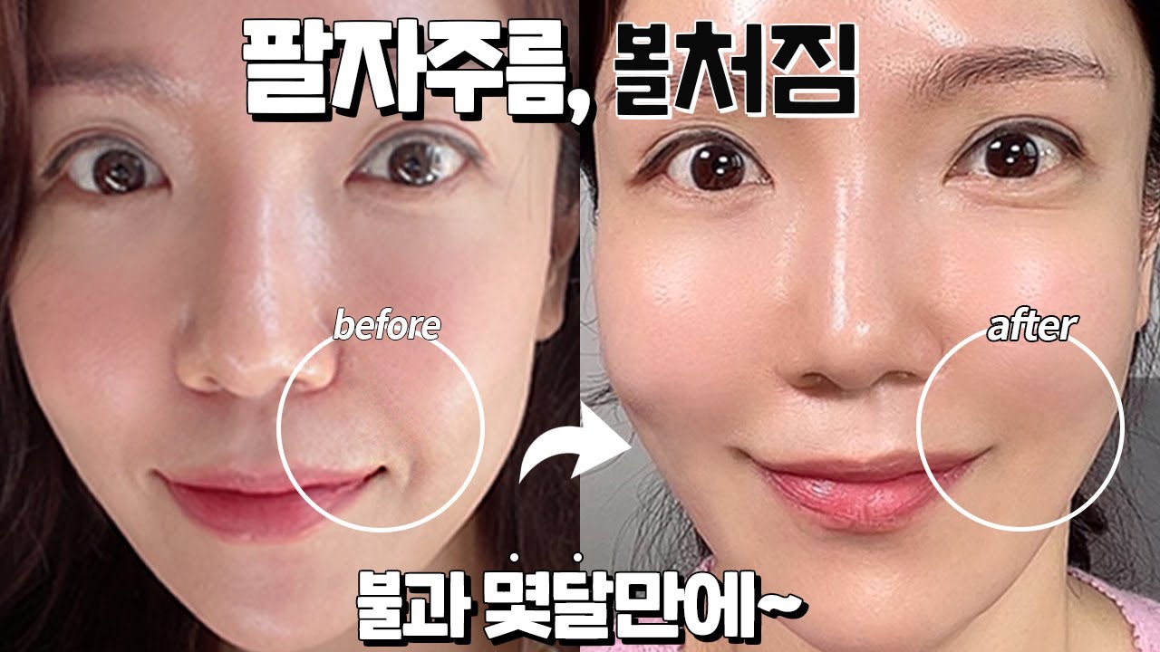 팔자주름and볼처짐 초간단 셀프 경락마사지 효과 무너진 얼굴 윤곽들을 찾아줘요😊 Youtube
