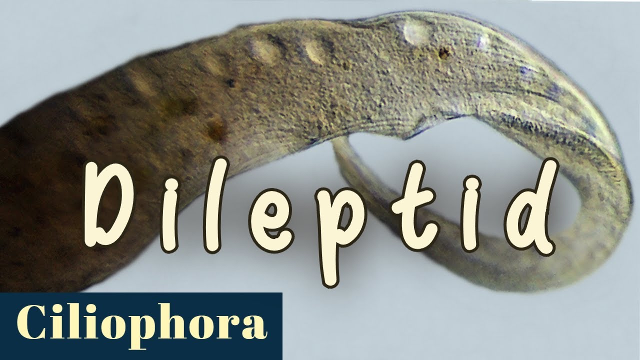 Large dileptid ciliate (Ciliophora) - YouTube