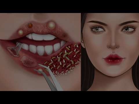 asmr treatment animation || Lips Care || - YouTube