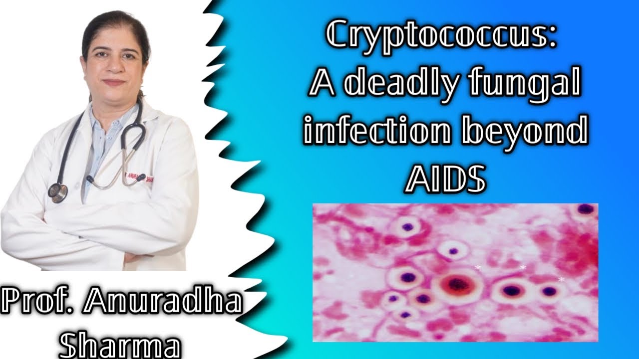 Cryptococcus: A Deadly Fungal Infection Beyond AIDS| Cryptococcosis ...