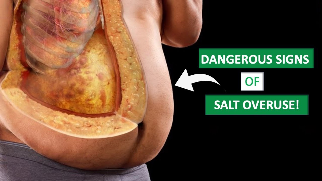 9 Shocking Signs You're Eating Too Much Salt - YouTube