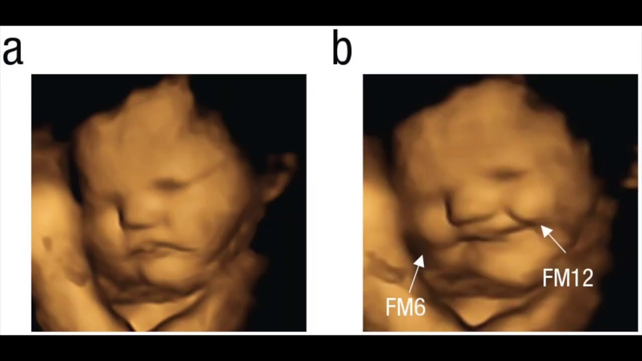 Fetuses in the womb smiled after their mothers ate carrots but scowled ...