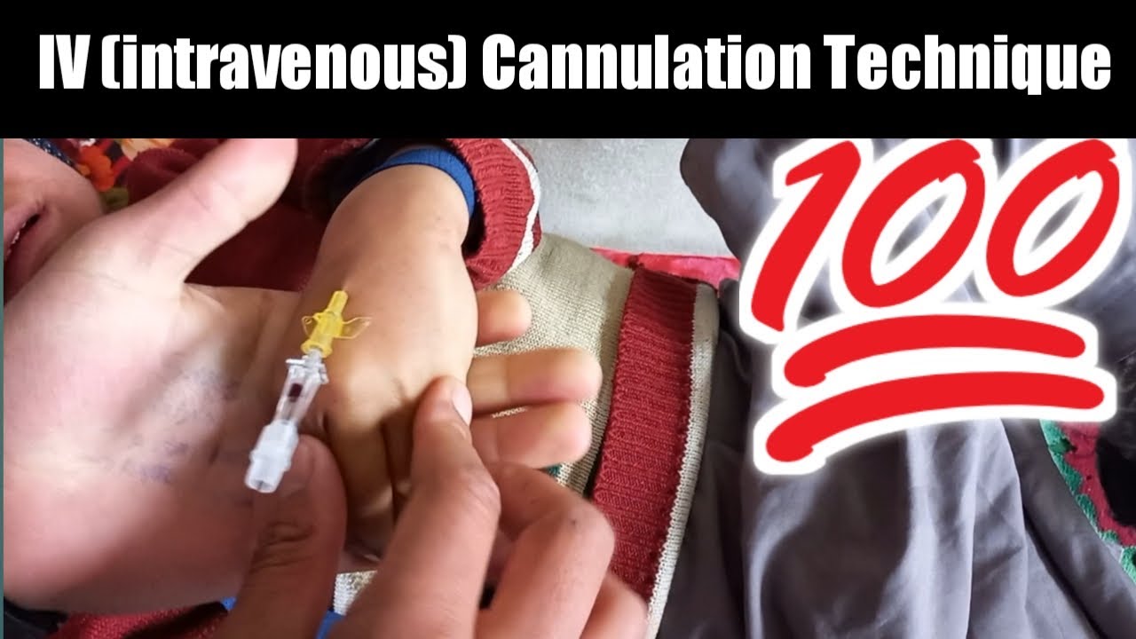 How To Pass iv line Easily | How to Pass Cannula in 1 Minute. # ...
