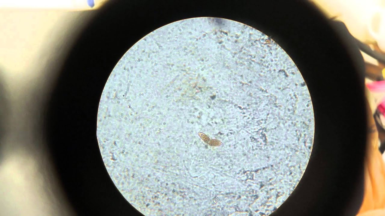 Bacteria swimming - look close - YouTube