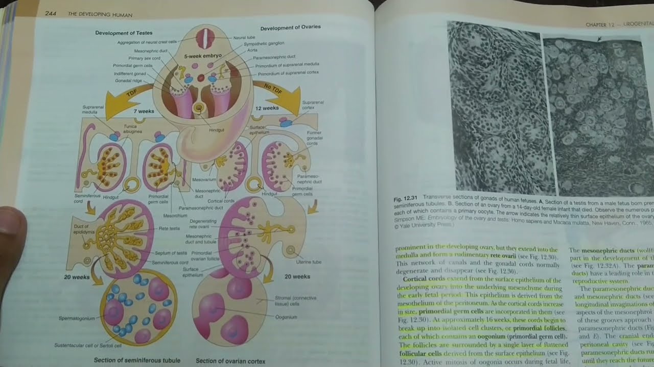 Development Of Gonads (Testis & Ovaries) - ANATOMY - YouTube