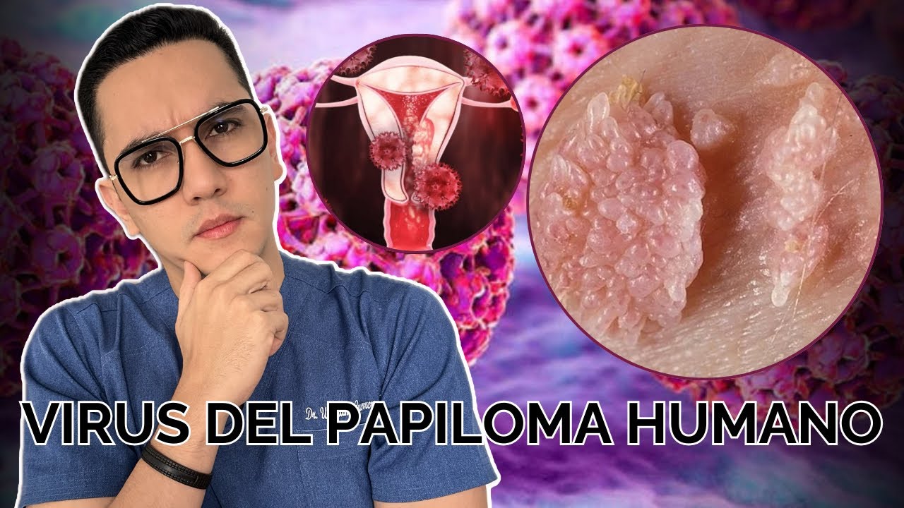 ¡Alerta! Virus del papiloma humano, una amenaza silenciosa | Dr. William Guerrero - YouTube