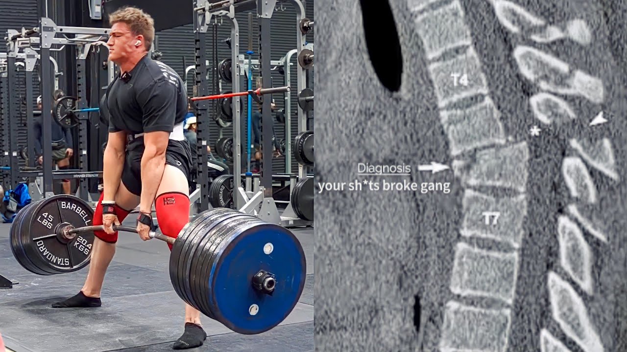 504 KG Deadlift Broke His Spine - YouTube