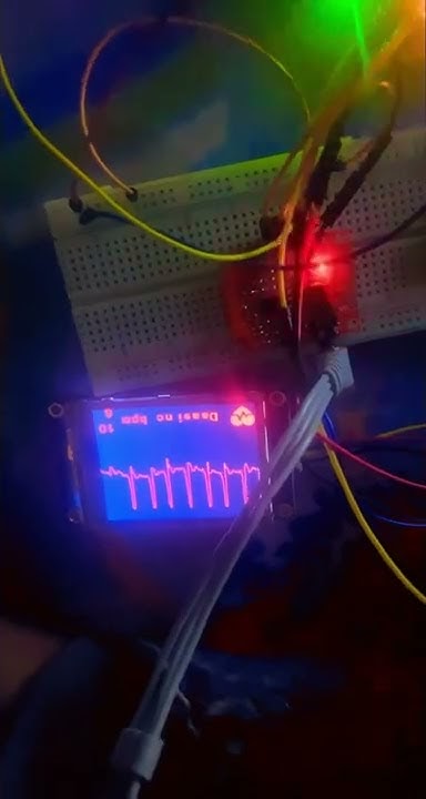 Ecg nextion arduino - YouTube