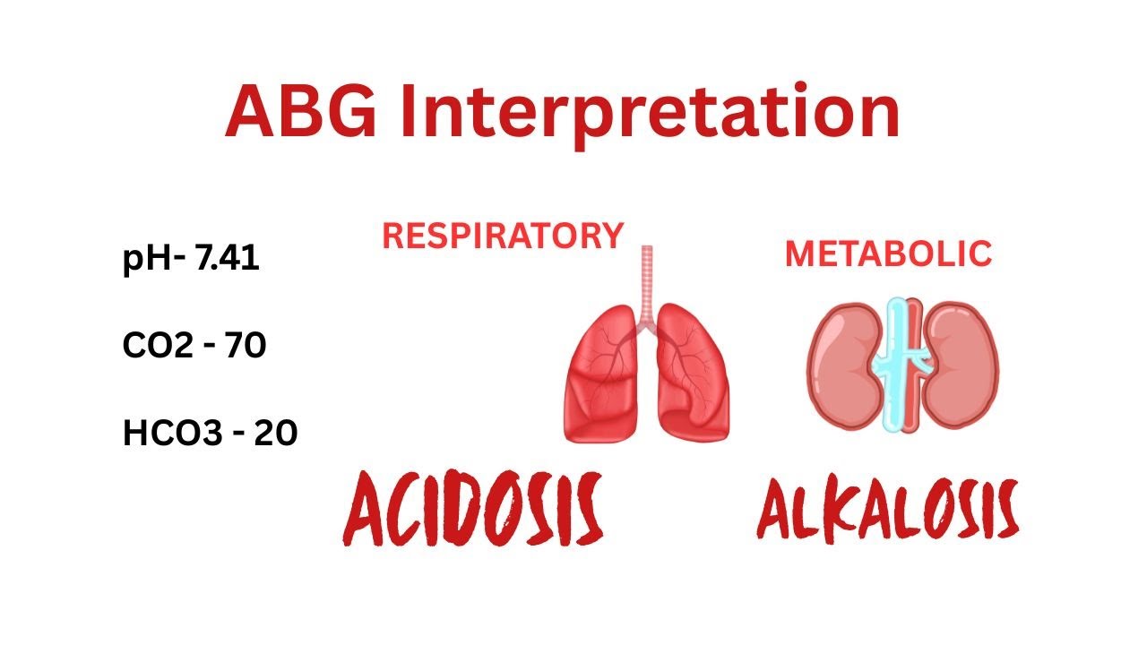 Arterial Blood Gases Interpretation #abgs | ABGS Made Easy and Simple ...