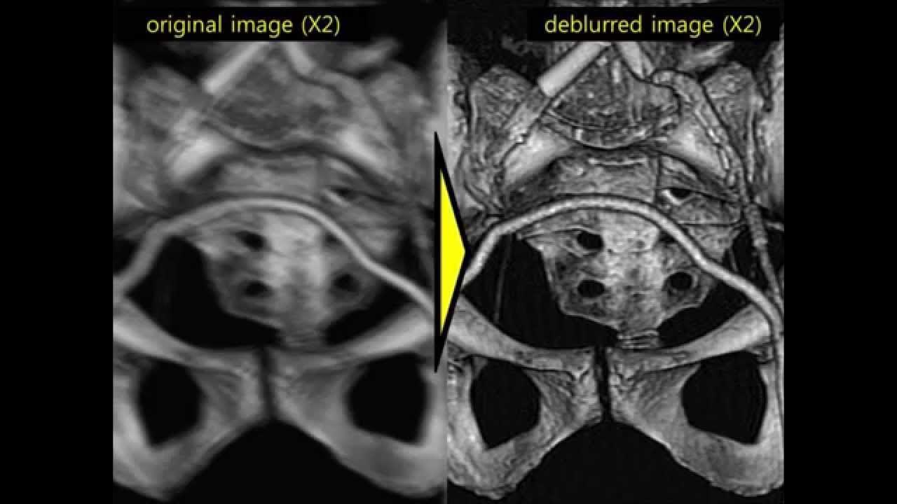 HyperSight: Real-Time Non-Blind Image Deconvolution using CUDA - YouTube