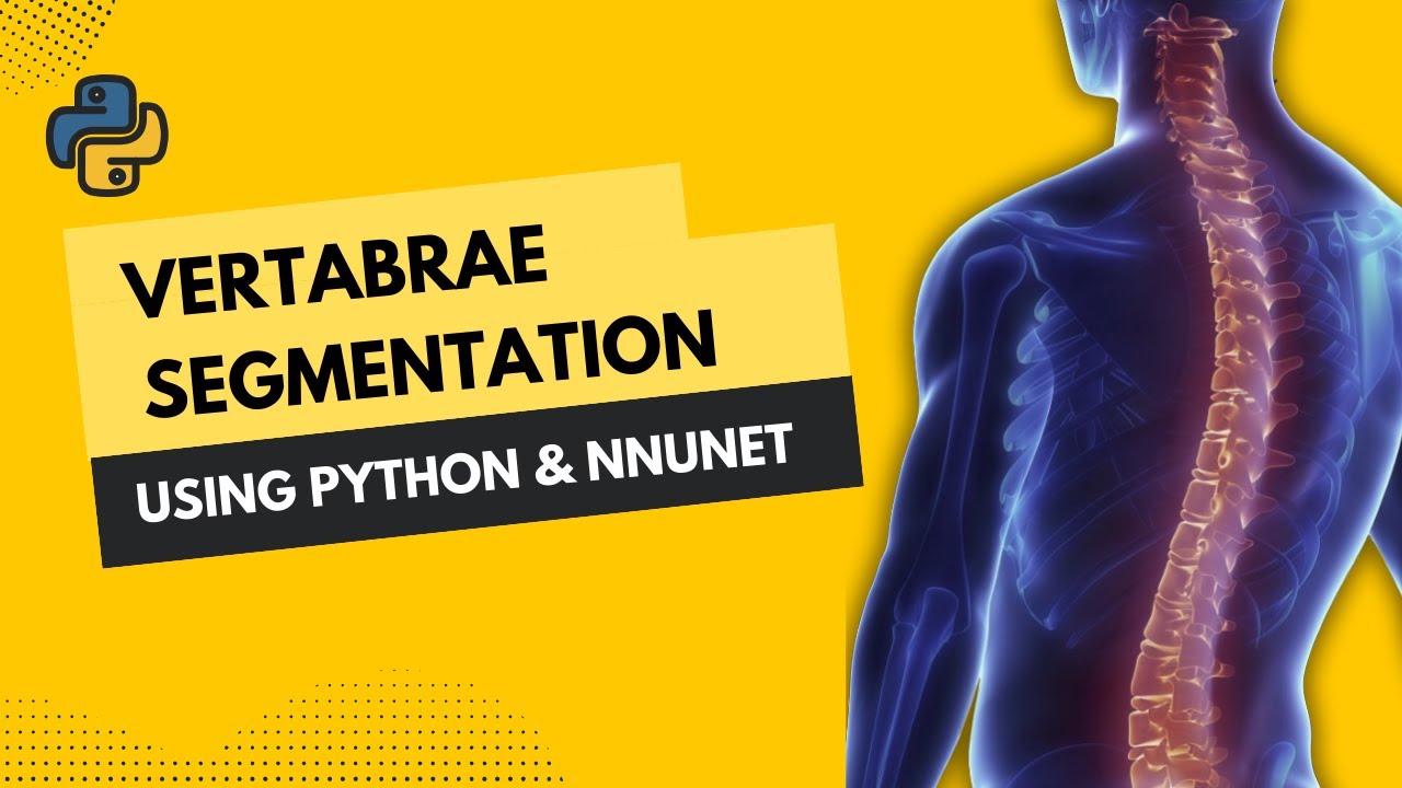 Vertabrae Segmentation using Python and nnUNetv2 - YouTube