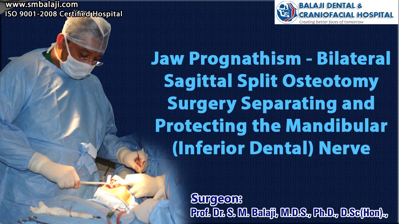 Jaw Prognathism-Bilateral Sagittal Split Osteotomy Surgery Separating ...