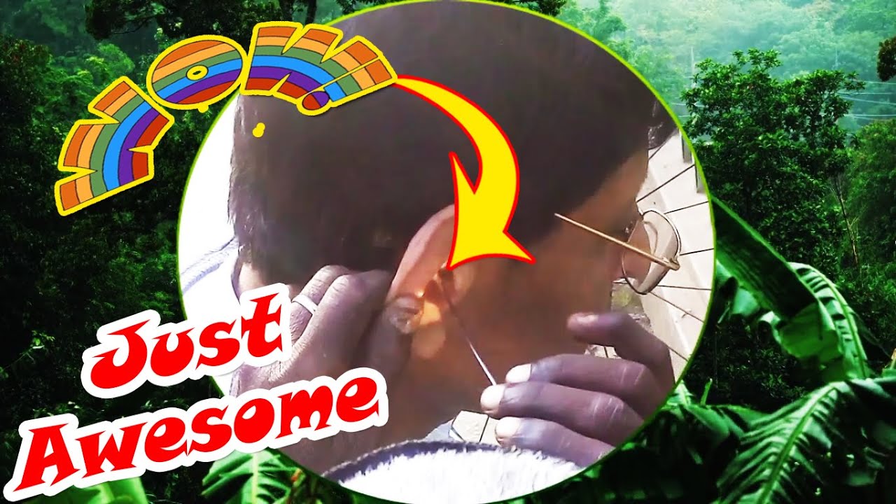 Huge Dirt Removal with Input GEL / Most Satisfying Ear Cleaning with ...