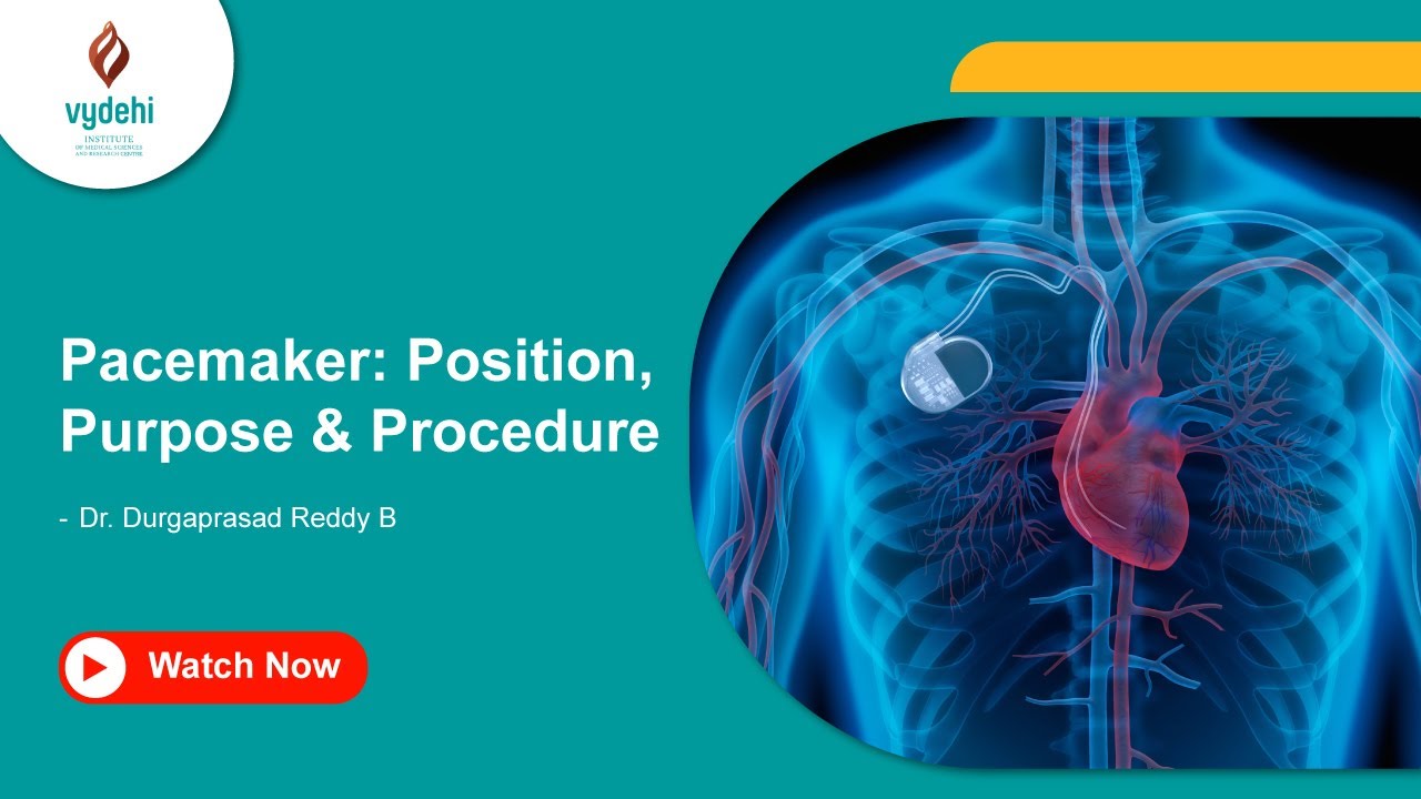 Pacemaker: Position, Purpose & Procedure - Dr. Durgaprasad Reddy B ...