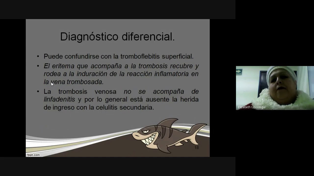 Homeopatía Av: Linfangitis - YouTube