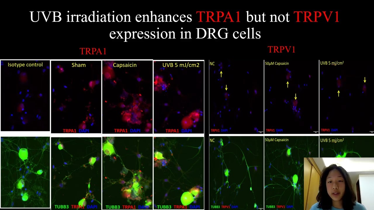 UVB induced TRPV1 and TRPA1 expression in skin keratinocyte and dorsal ...