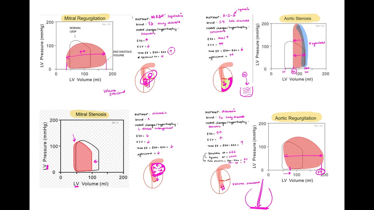 PV Loop - Cardiac physiology - YouTube