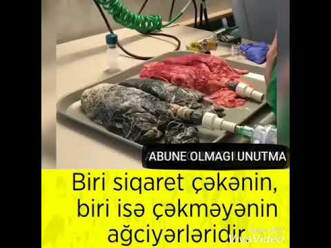 MUTLEQ IZLEYIN SOK !!