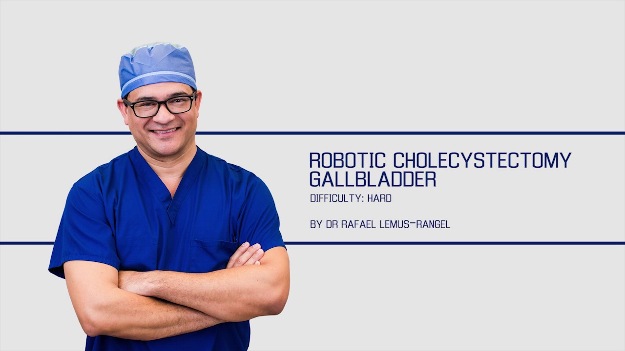 Difficult Cholecystectomy | Robotic Gallbladder Surgery - YouTube