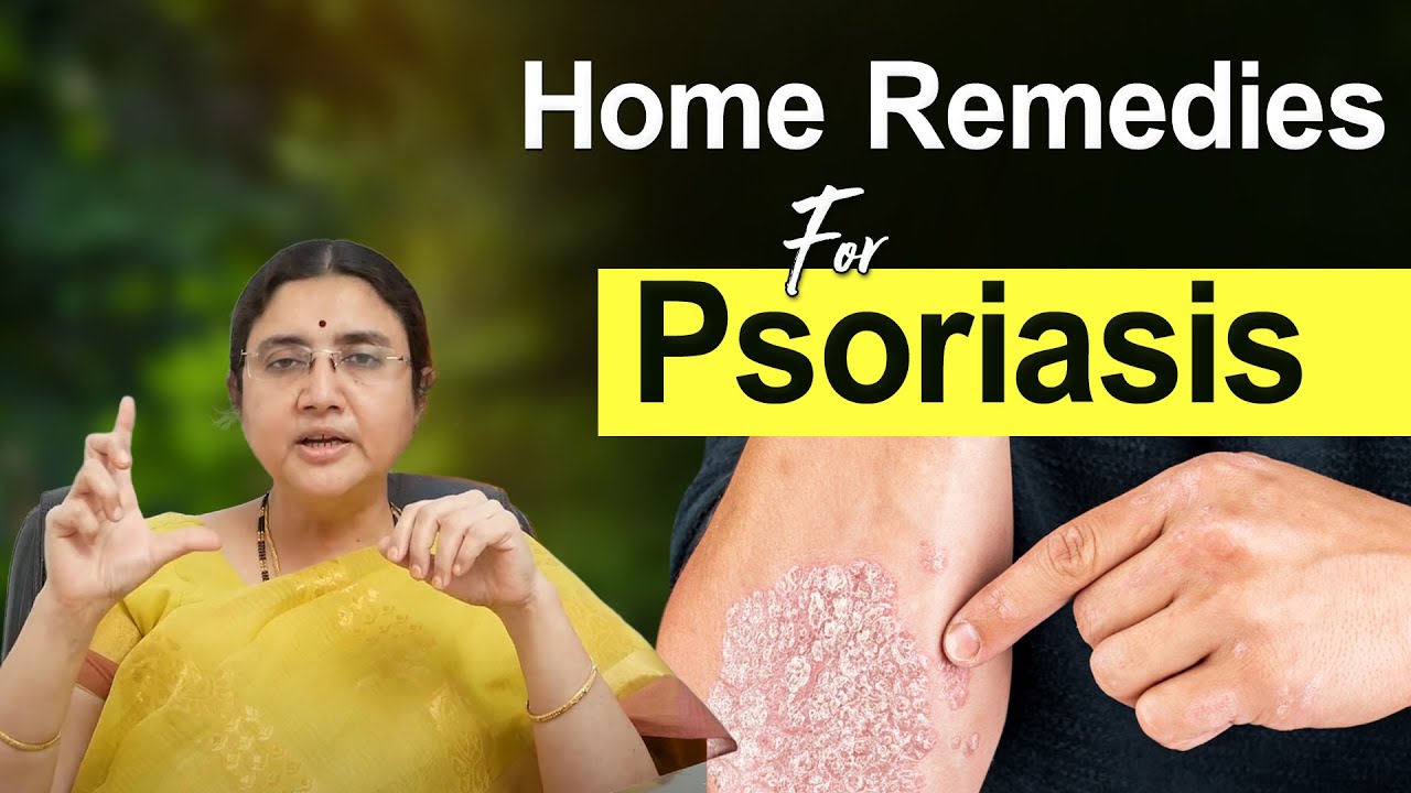 How to Cure Psoriasis | Psoriasis Treatment – The Best 3 Remedies for ...