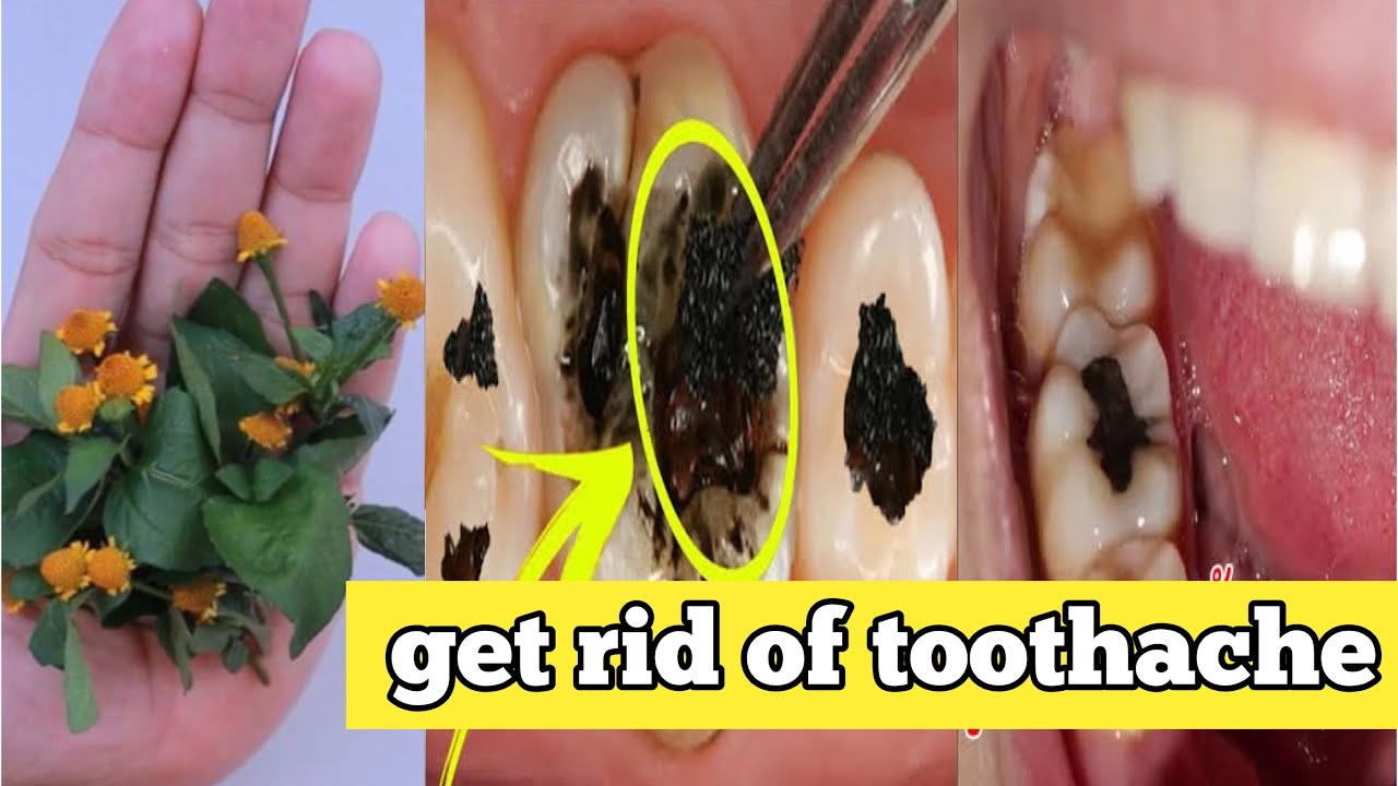 How to get rid of toothache in 1 minute || home remedy | - YouTube