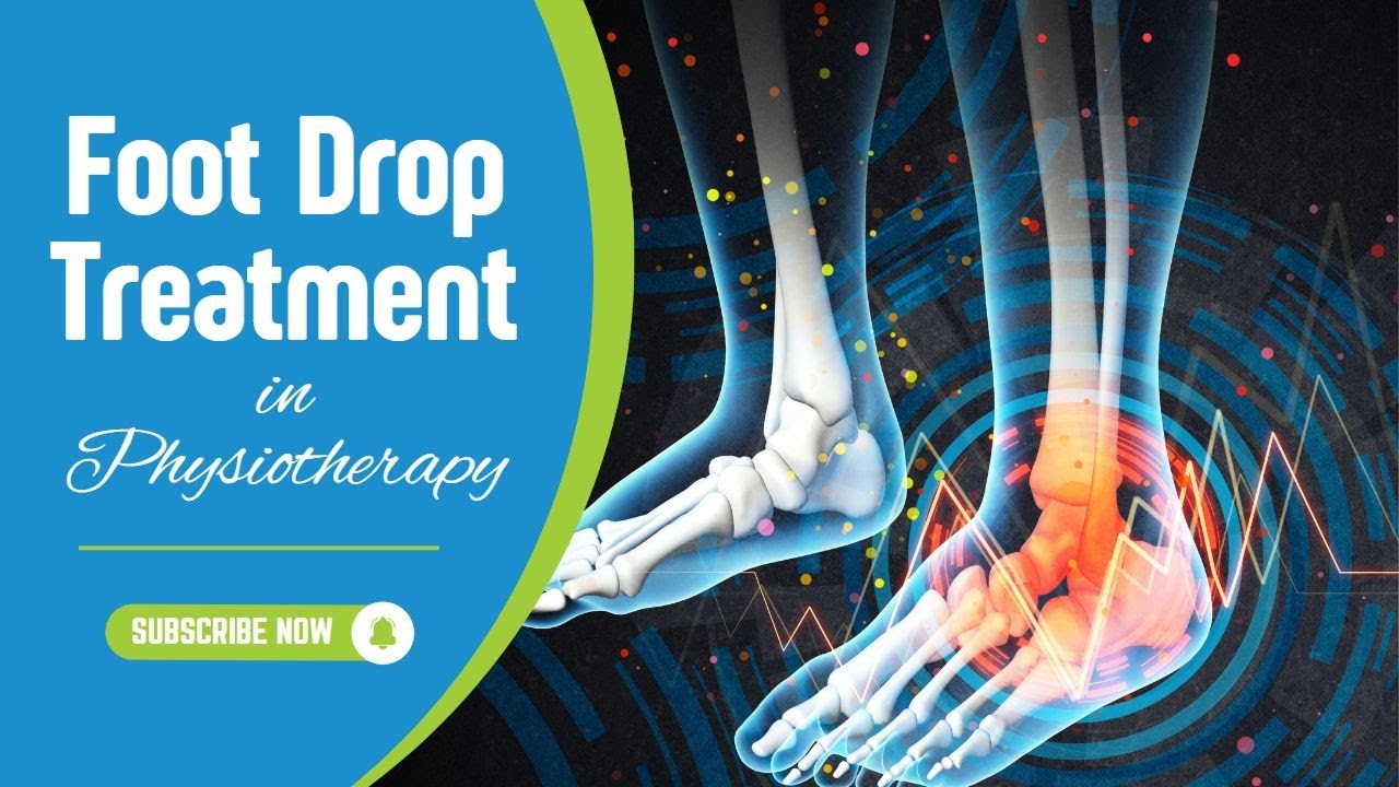 Foot Drop Treatment Physiotherapy - Foot Drop Nerve - YouTube