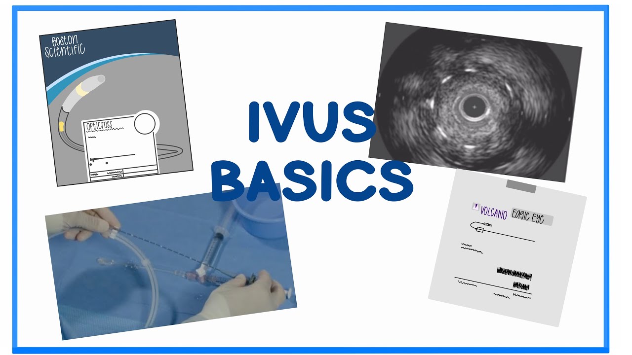 IVUS Basics - FULL Lesson - YouTube