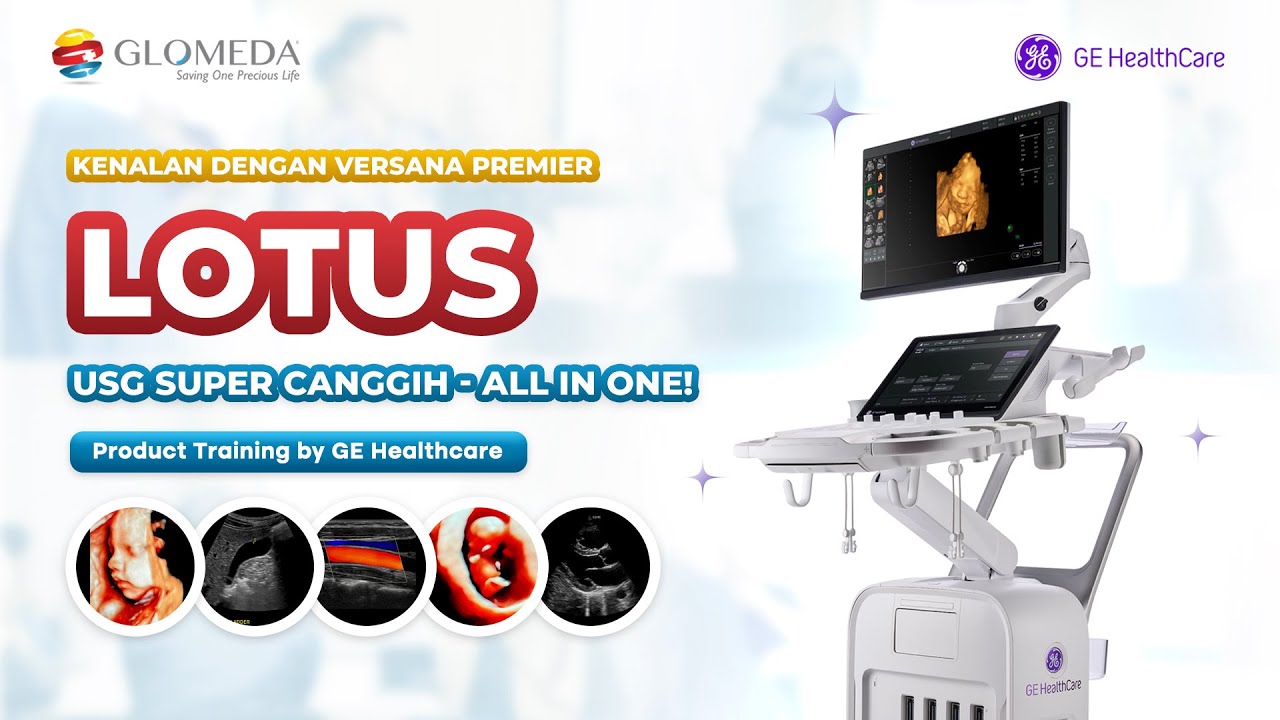 Kenalan dengan LOTUS! USG Super Canggih - All In One! - Product ...