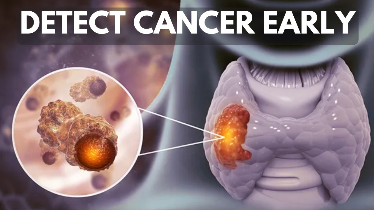 How to Detect Cancer in Its Early Stages - YouTube
