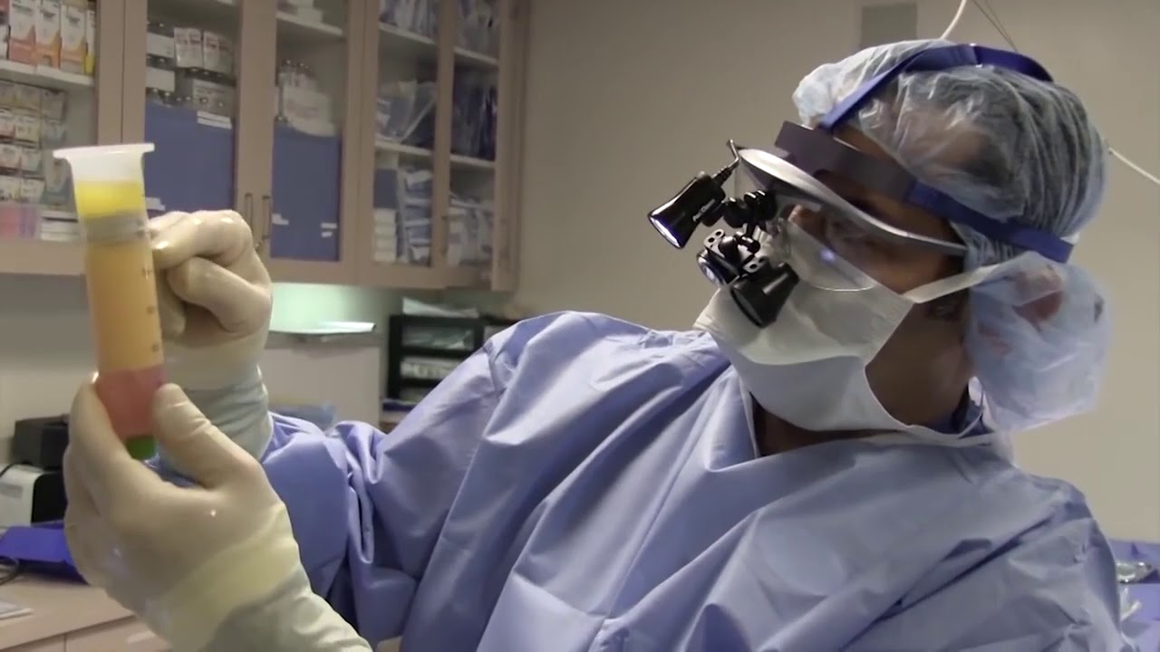 Adivive Fat Transfer System ( Medikan Lipokit ) - YouTube