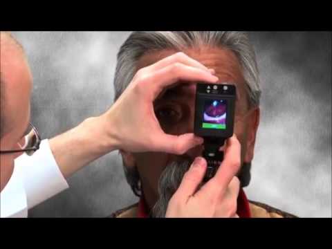 EyeQuick Digital Ophthalmoscope Camera - YouTube