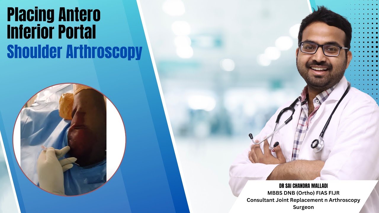 Placing Antero Inferior Portal.. Shoulder Arthroscopy..Dr Sai Chandra ...